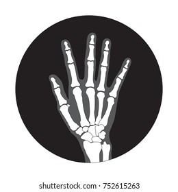 Hand Xray Image Icon Vector Illustration Stock Vector (Royalty Free ...
