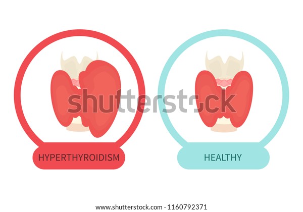 Healthy Thyroid Gland Hyperthyroidism Symbols Made Stock Vector ...