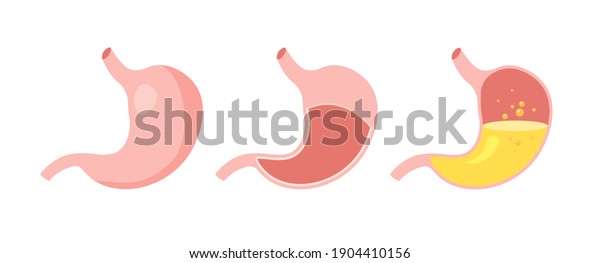 4,937 Gaster Images, Stock Photos & Vectors | Shutterstock