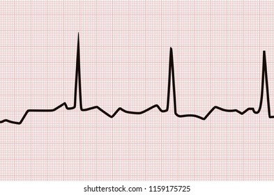 Steady Arrow Graph Stock Illustration 41358652 | Shutterstock