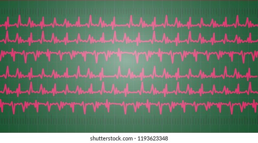Heart Pulse Graphic Vector Illustration Eps Stock Vector (Royalty Free ...