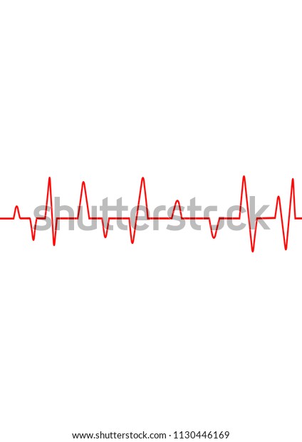 Heart Rate Graphic Vector Illustration Electrocardiogram Stock Vector ...