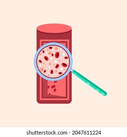 49 imágenes de Hemogram - Imágenes, fotos y vectores de stock ...