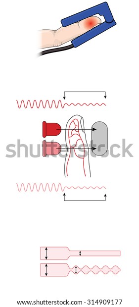 How Pulse Oximeter Works Showing Absorption Stock Vector (Royalty Free ...