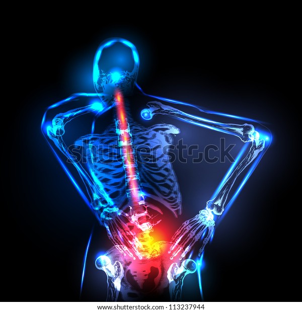 Human Backbone Xray Back Pain Easy Stock Vector (Royalty Free) 113237944
