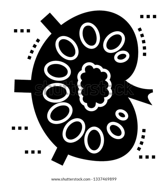 Human Bean Shaped Organ Kidney Stock Vector (Royalty Free) 1337469899 ...