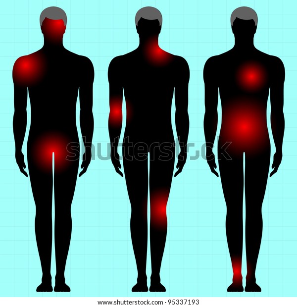 Human Body Area Pain Stock Vector (Royalty Free) 95337193 | Shutterstock