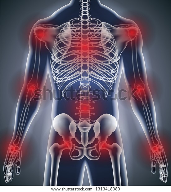 Human Body Xray Bone Anatomy Joints Stock Vector (Royalty Free) 1313418080