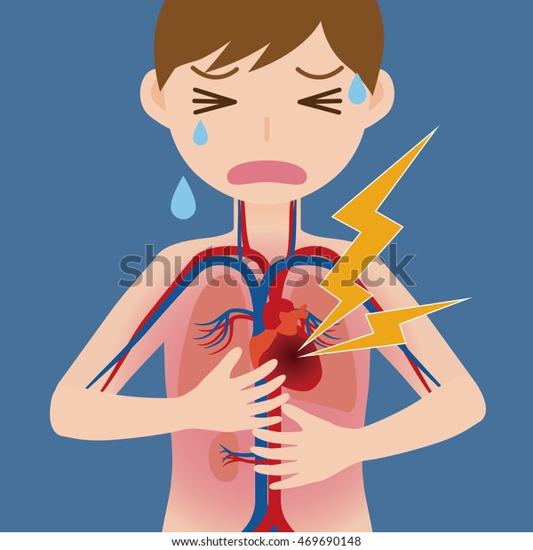 Human Circulatory System Heart Infarction Cardiac: vetor stock (livre ...