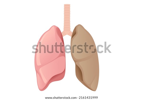 Vektor Stok Human Damaged Lungs Cartoon Design Human (Tanpa Royalti ...