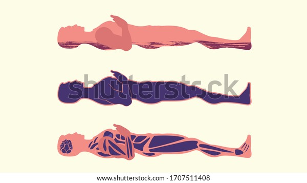 Human Dead Body Vector Illustration Postmortem 库存矢量图（免版税）1707511408 ...