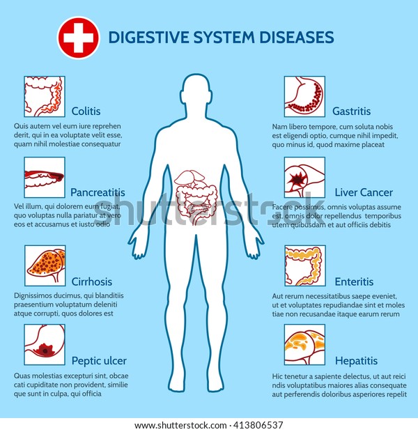 Human Digestive System Diseases Medical Infographics Stock Vector ...