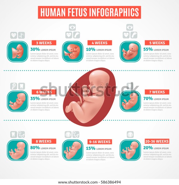 Human Fetus Infographics Layout Realistic Style Stock Vector (Royalty ...