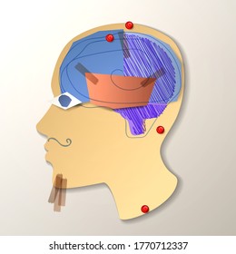 Human Head Brain Cut Out Pieces Stock Vector (Royalty Free) 1770712337 ...