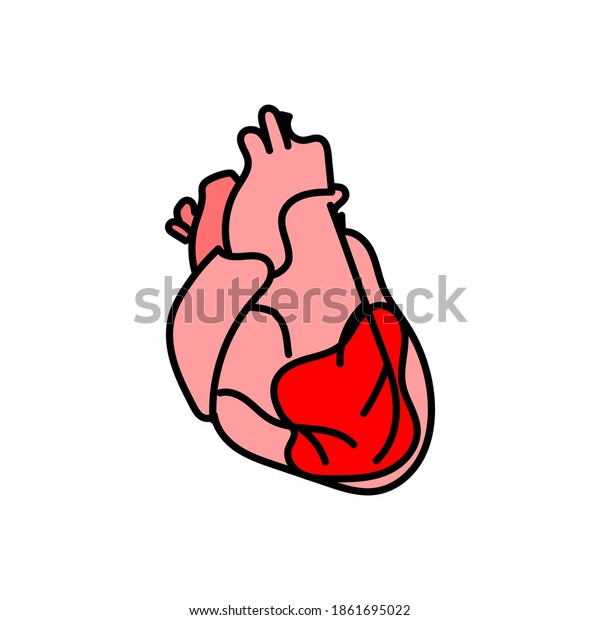 Human Heart Icon Stroke Myocardial Infarction Stock Vector (Royalty ...