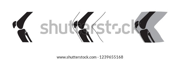 Stock vektor „Human Knee Skeletal Anatomy Vector Illustrations“ (bez ...