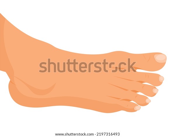 Human Legs Feet Vector Illustration Advertising Stock Vector (Royalty ...