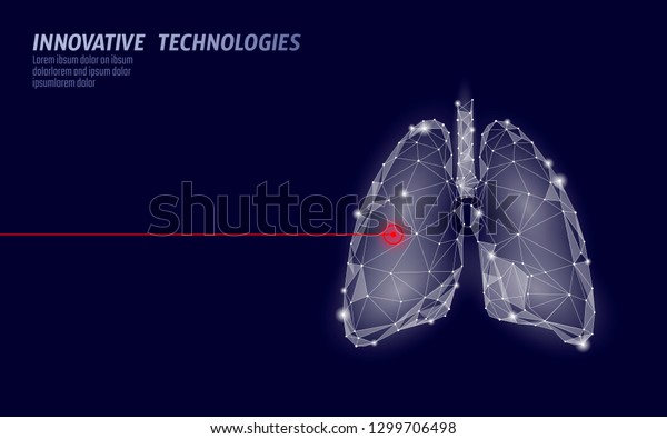 Human Lungs Laser Surgery Operation Low Stock Vector (Royalty Free ...