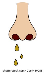 Human Nose Front View Patient Has Stock Vector (Royalty Free ...