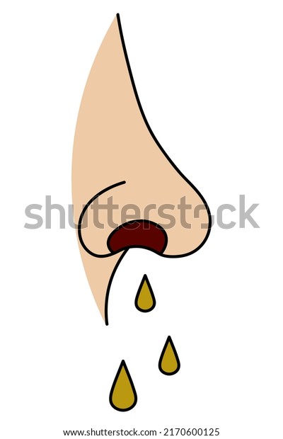 Human Nose Side View Patient Has: เวกเตอร์สต็อก (ปลอดค่าลิขสิทธิ์ ...