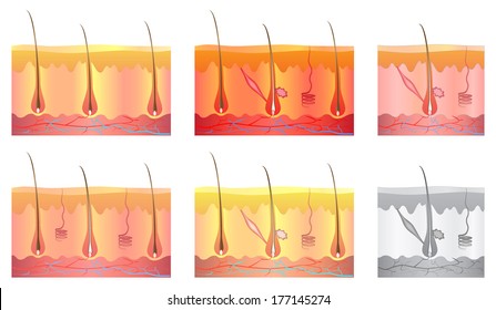 661 Hair follicle cross section Stock Illustrations, Images & Vectors ...