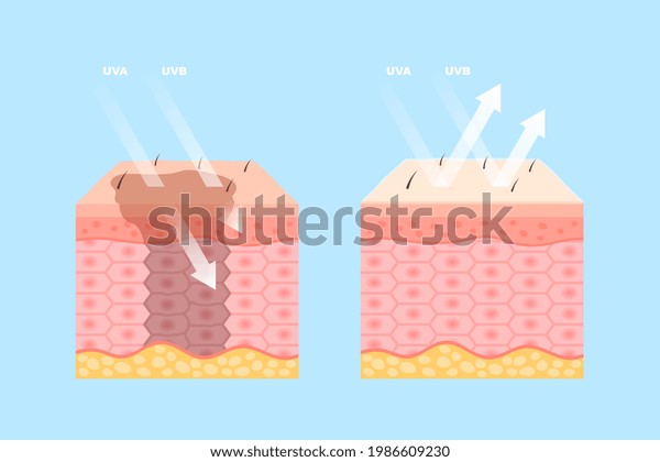 Human Skin Protection Ultraviolet Rays Effect Stock Vector (Royalty ...