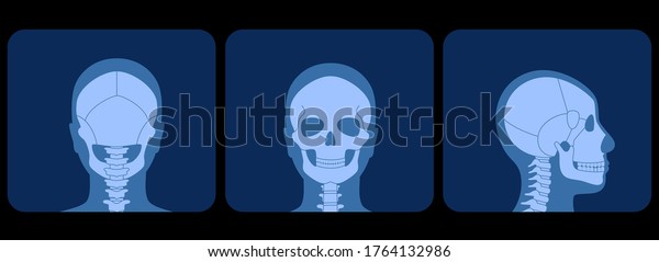 Human Skull Anatomy Front Profile Back Stock Vector (Royalty Free ...
