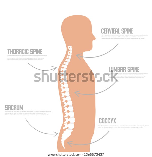 Human Spine Anatomy Vector Illustrationspine Medical 스톡 벡터(로열티 프리 ...