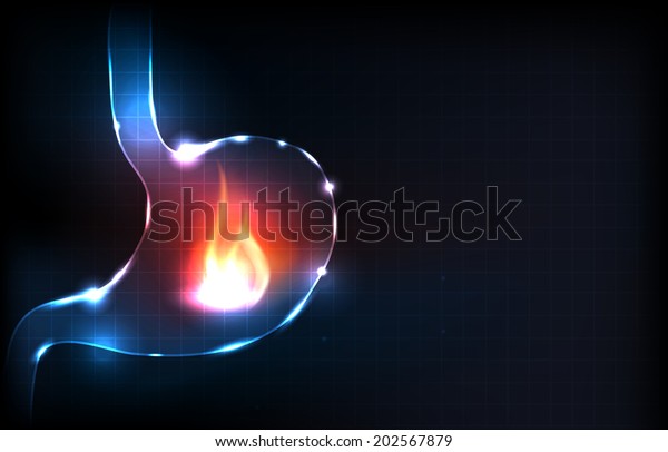 Human Stomach Burning Fire Stomach Stomach Stock Vector (Royalty Free ...