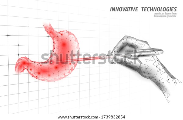 Human Stomach Laser Surgery Operation Low Stock Vector (Royalty Free ...