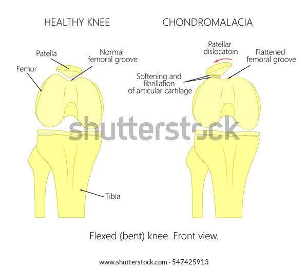 Illustration Diagram Normal Knee Joint Knee Stock Vector (Royalty Free ...