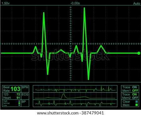 Illustration Electrical Activity Human Heart Rate Stock Vector (Royalty ...