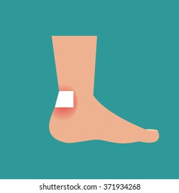 Illustration Foot Callus Plaster Stock Vector (Royalty Free) 371934268 ...