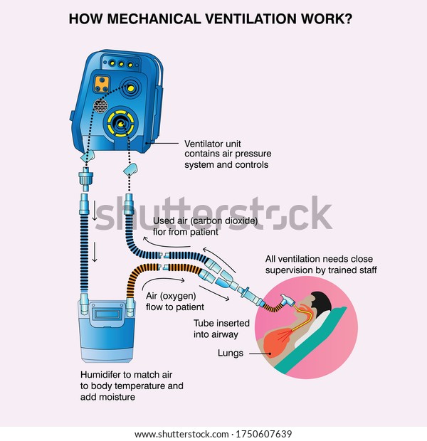 Illustration How Mechanical Ventilator On Corona Stock Vector (Royalty ...