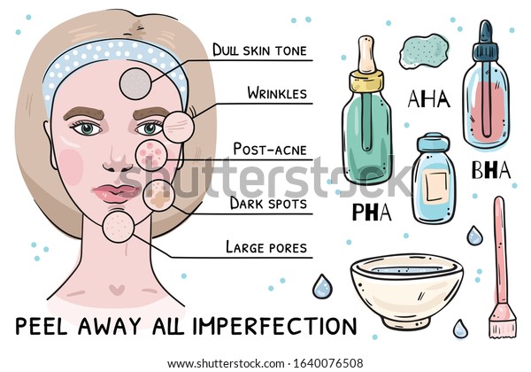 Illustration Skin Problems That Acid Peeling 스톡 벡터(로열티 프리) 1640076508 ...