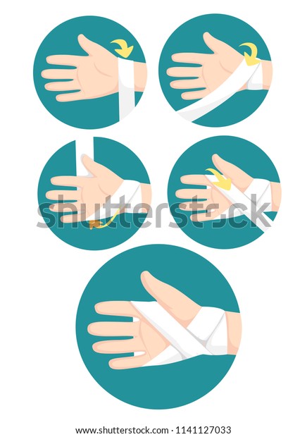Illustration Steps How Apply Bandage Hands Stock Vector (Royalty Free ...