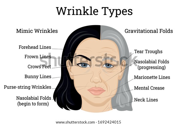 Illustration Two Types Wrinkles Such Mimic Stock Vector (Royalty Free ...