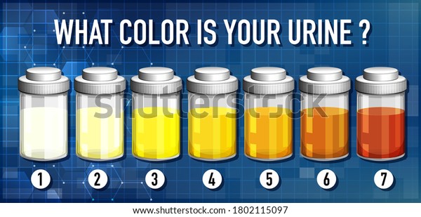 Illustration Urine Color Chart Illustration: เวกเตอร์สต็อก (ปลอดค่า ...