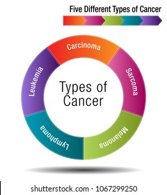 Image Five Different Types Cancer Chart Stock Vector (Royalty Free ...