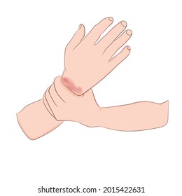 Image Graphics Vector Outline Wrist Pain Stock Vector (Royalty Free ...