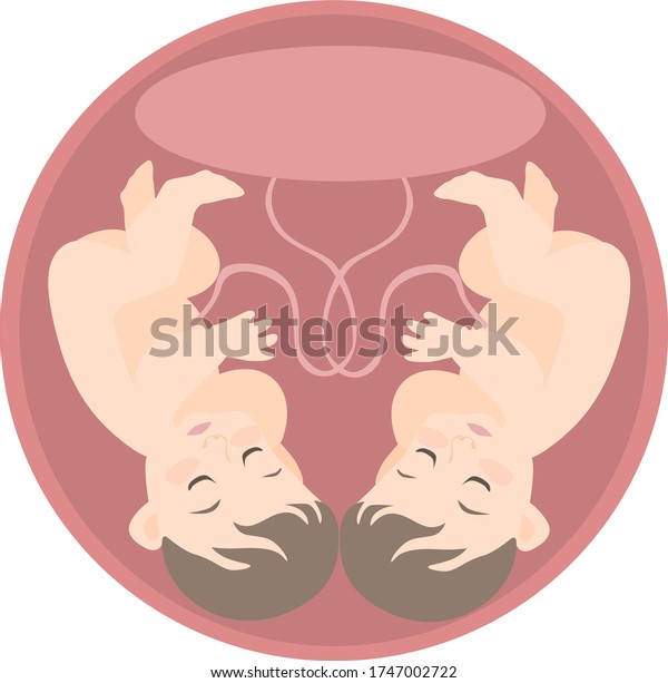 Image Two Identical Embryos Uterine Cavity Stock Vector (Royalty Free ...