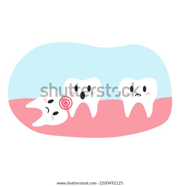 Impacted Wisdom Tooth Cartoon Flat Style Stock Vector (Royalty Free ...