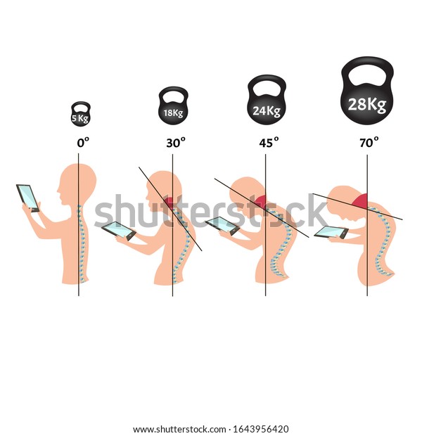 Improper Posture Symptoms Stage Text Neck Stock Vector (Royalty Free ...