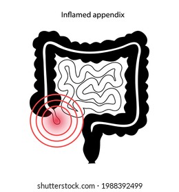 Inflamed Appendix Logo Appendicitis Pain Intestine Stock Vector ...