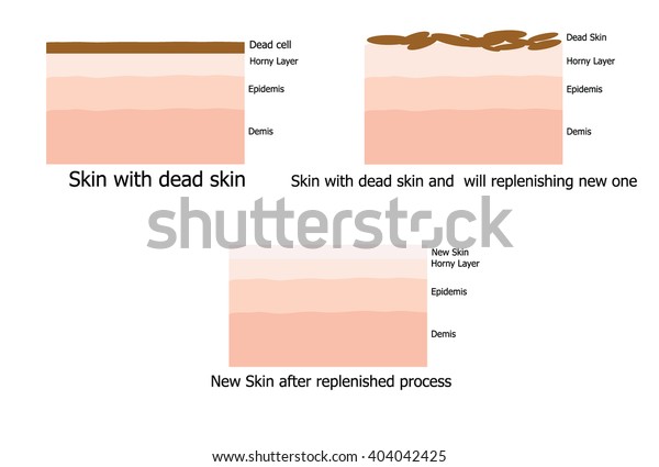 Infographic About Skin Replenishing Process Since Stock Vector (Royalty ...