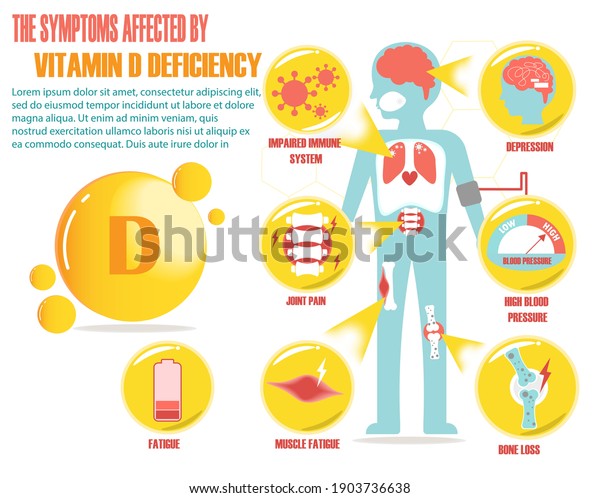 Infographic Vitamin D Deficiency Vector Design Stock Vector (Royalty ...