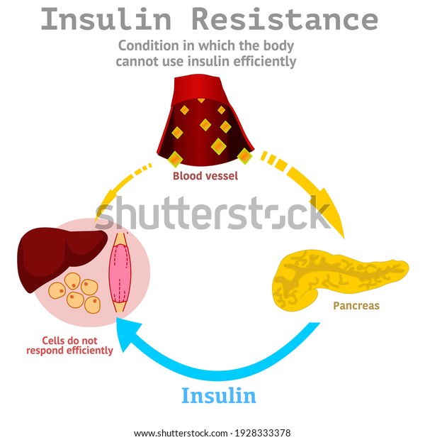 Insulin Resistance Insufficient Response Body Tissues Stock Vector ...
