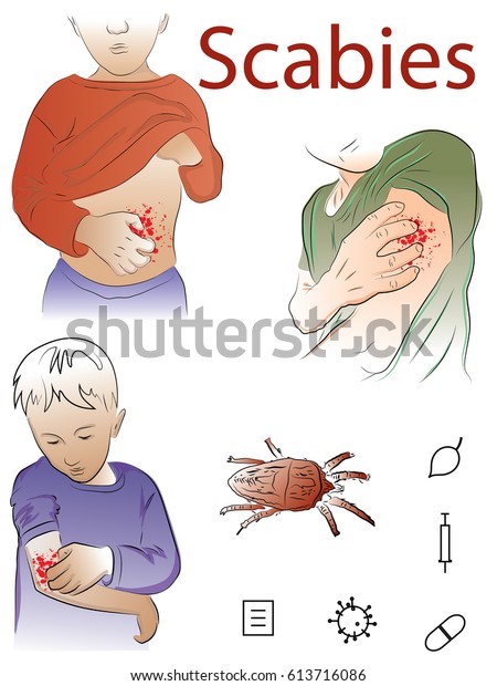 Vector de stock (libre de regalías) sobre Picor Del Cuerposcabies Del ...