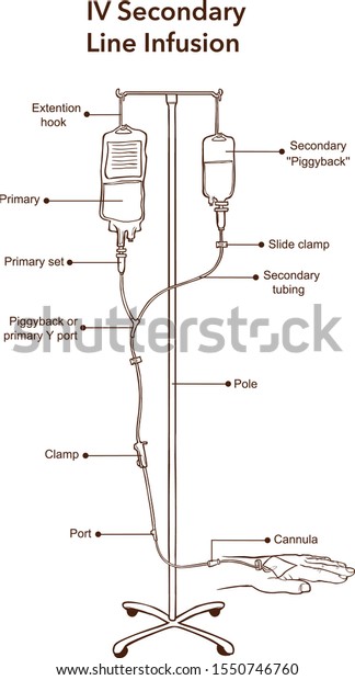 IV Secondary Line Infusion vector illustration