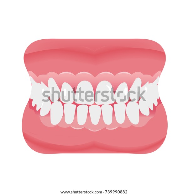 Jaw Teeth Icon Flat Style Open Stock Vector (Royalty Free) 739990882